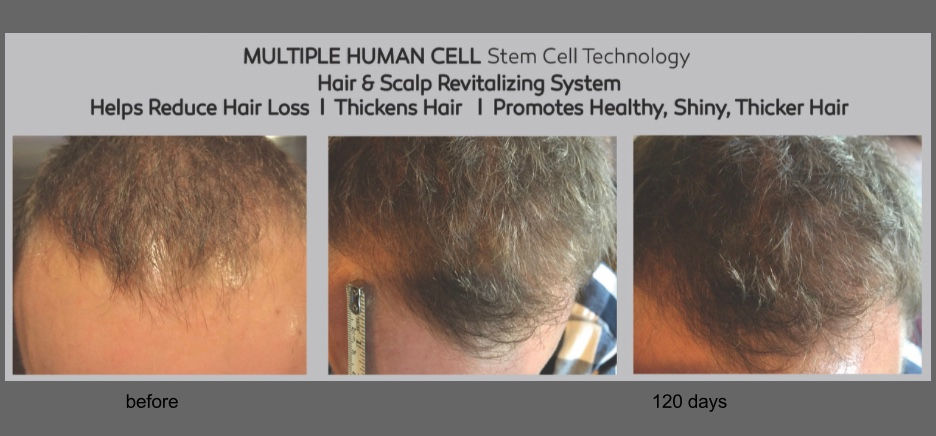 Hair & Scalp Revitalizing Spray with MHCsc™ Technology – Keracell